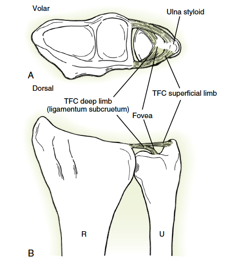 Lesão da fibrocartilagem triangular: o que é?